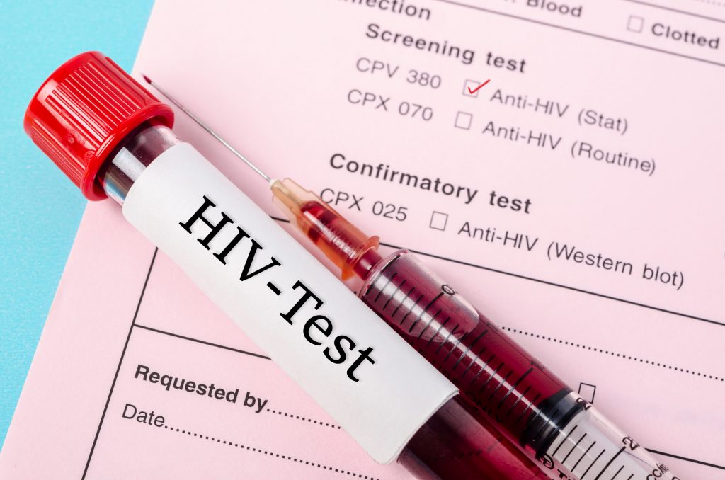 HIV test requirement for Filipinos bound for Oman under verification ...