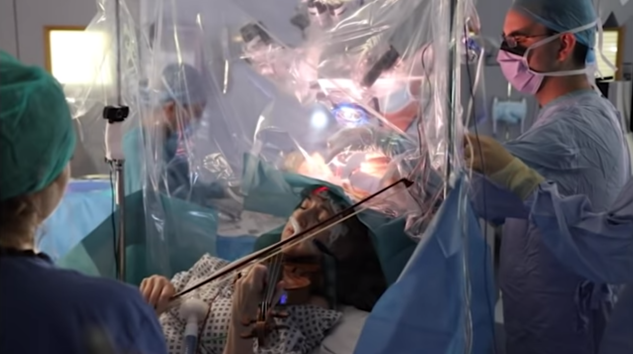 WATCH: Patient plays violin during brain surgery - The Filipino Times