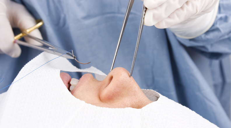 3 doctors sentenced jail-time, fine, deportation for botched nose job ...