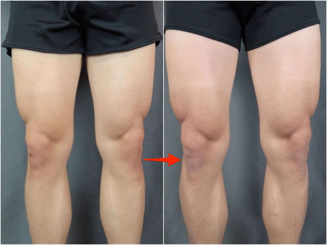 WATCH: YouTuber builds extra-inch quads off 300 bodyweight squats - The ...