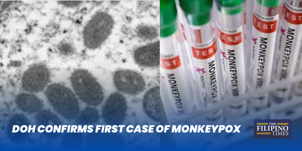 PH confirms first case of Monkeypox - The Filipino Times